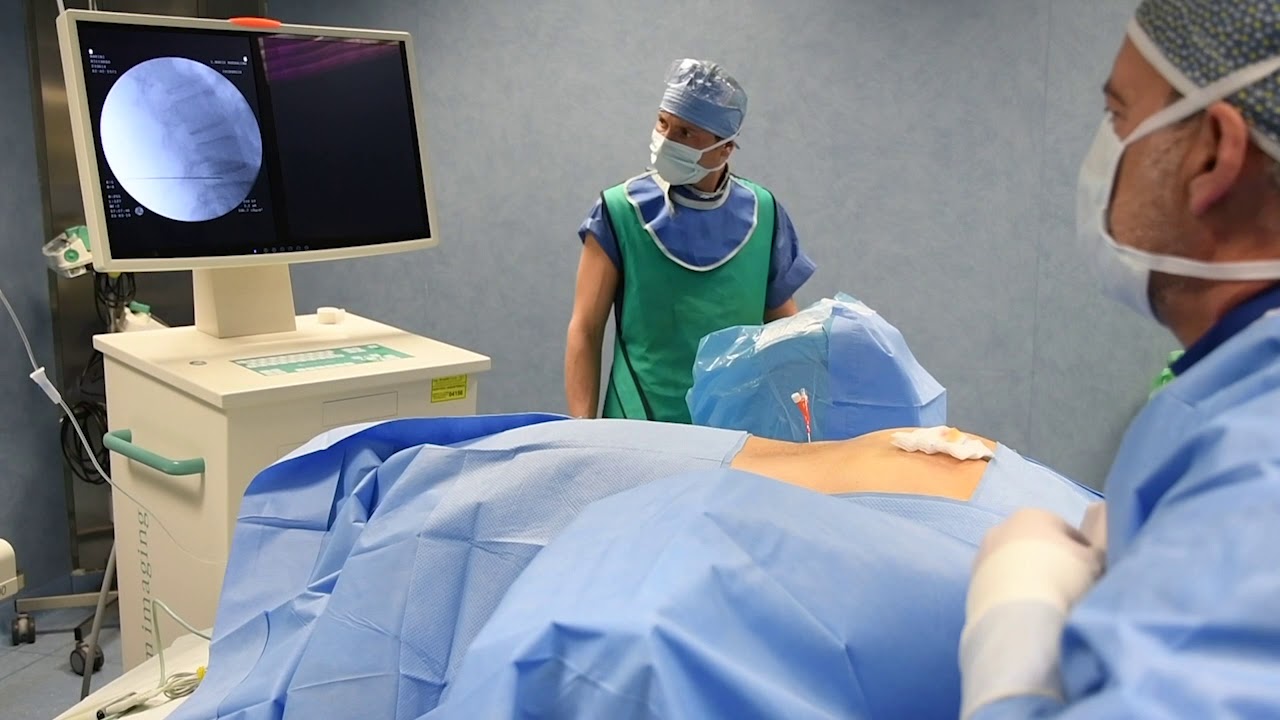 Trattamento miniinvasivo di ernia discale. Decompressione meccanica e ...