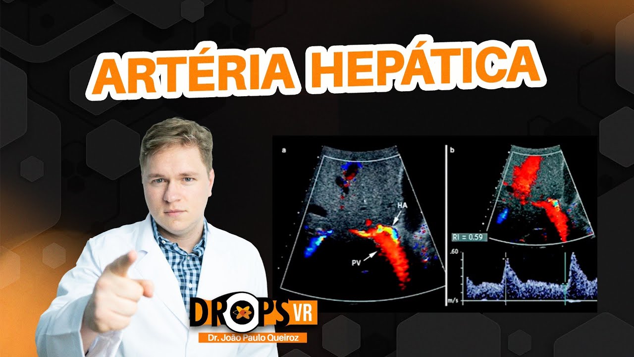 ANATOMIA VASCULAR NO DOPPLER HEPÁTICO – ARTÉRIA HEPÁTICA I VOCÊ ...