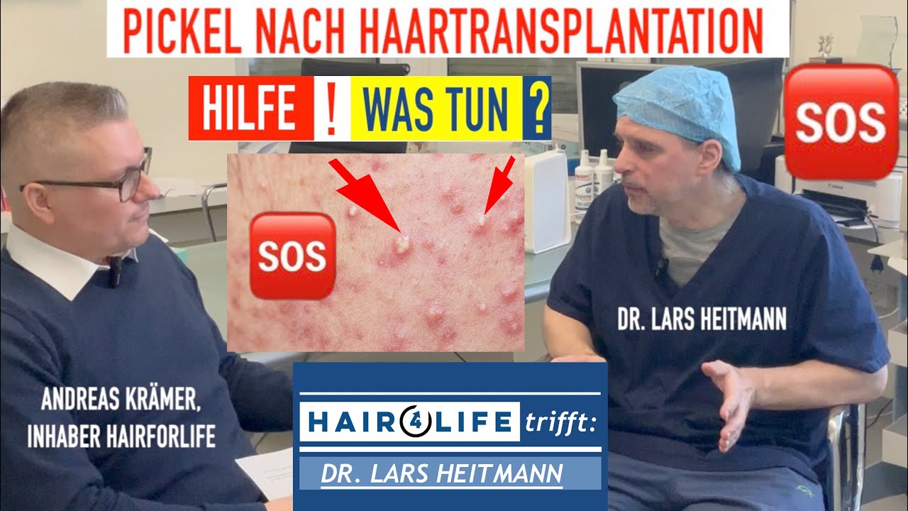 Hilfe 🆘! Pickel nach Haartransplantation (Empfänger & Donor)⚠️ Was tun ...