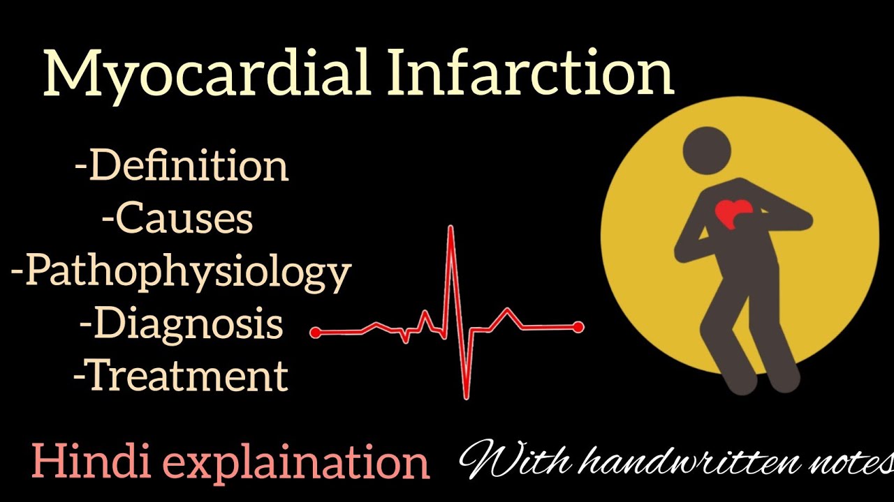 Myocardial Infarction | Heart Attack | Definition | Symptoms ...