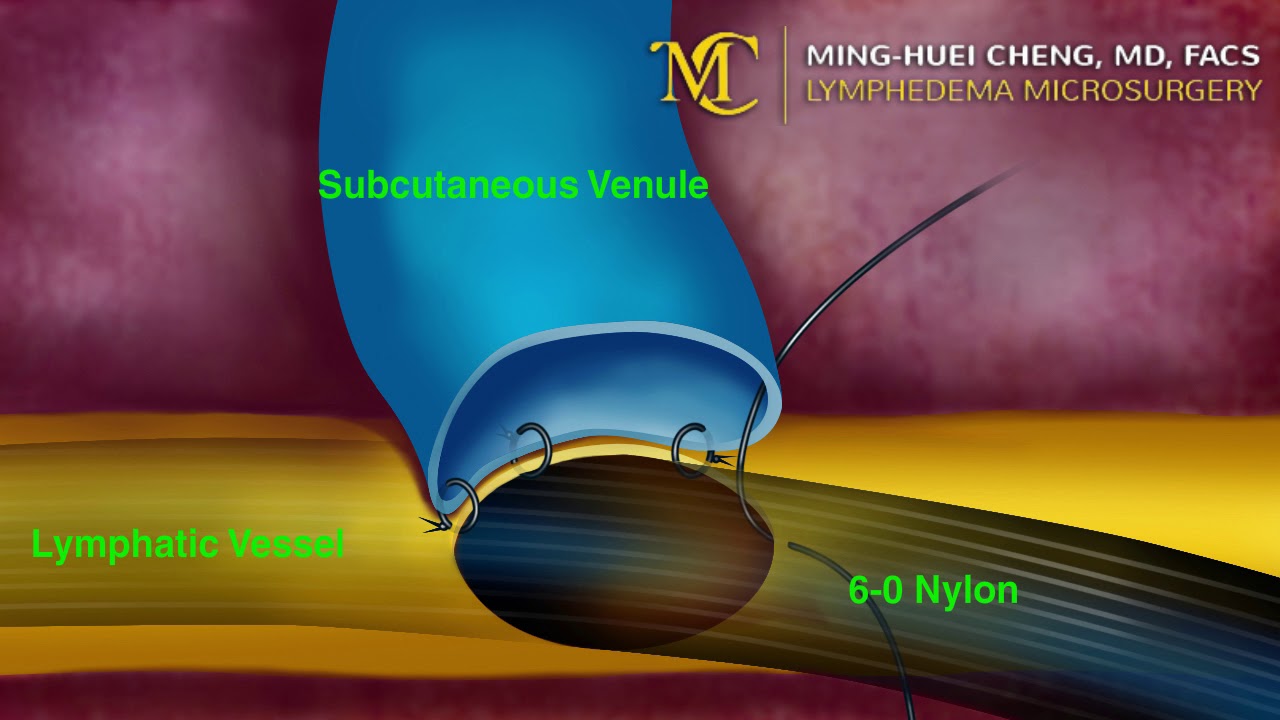 LVA Animation - YouTube