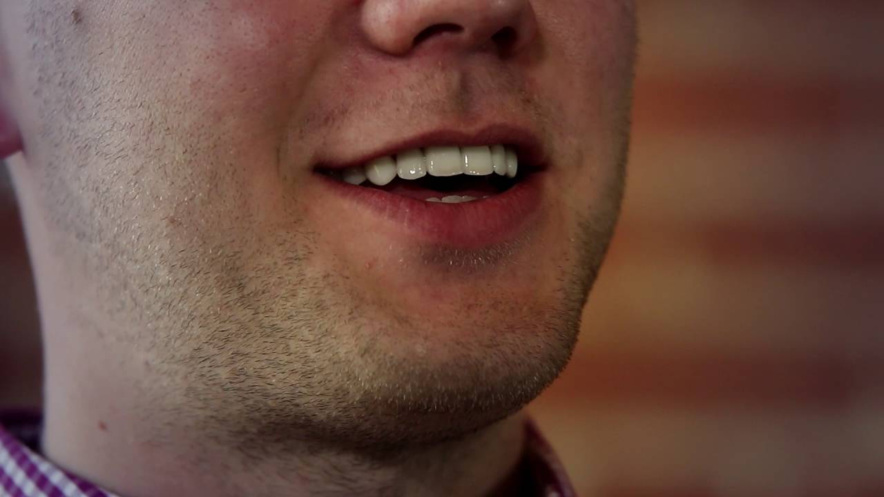 Paxton's New Smile - Jason White Dentistry - YouTube