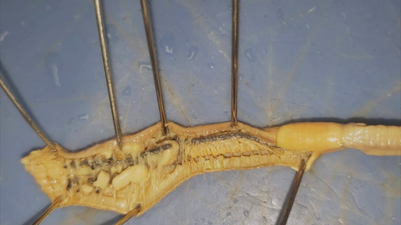 Earthworm Dorsal Blood Vessel