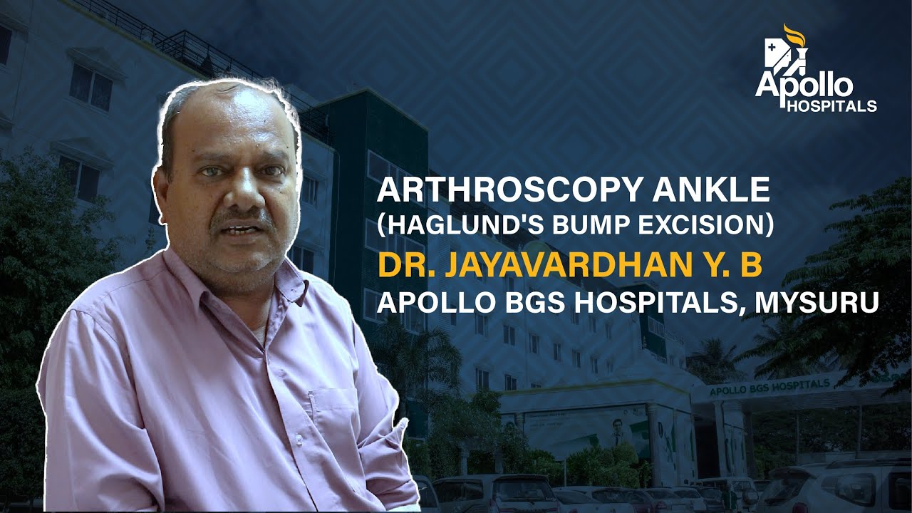 Arthroscopy Ankle (Haglund's Bump Excision) | Dr. Jayavardhan Y. B ...