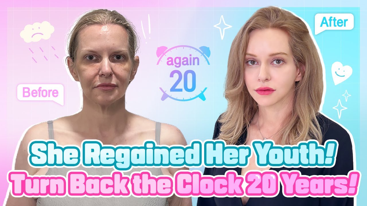 Watch How She Regains Her Youth with Amazing Results from DA Plastic ...