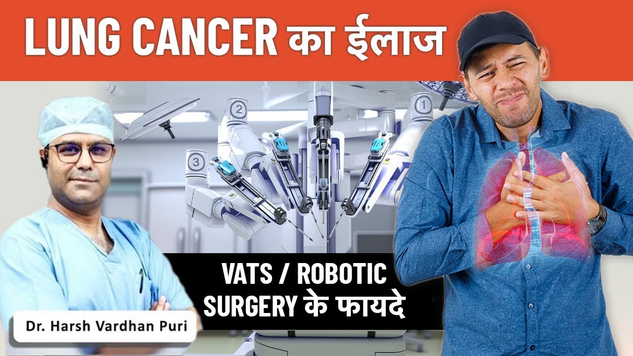 Lung Cancer Treatment | Benefits Of Robotic Surgery | Video-Assisted ...