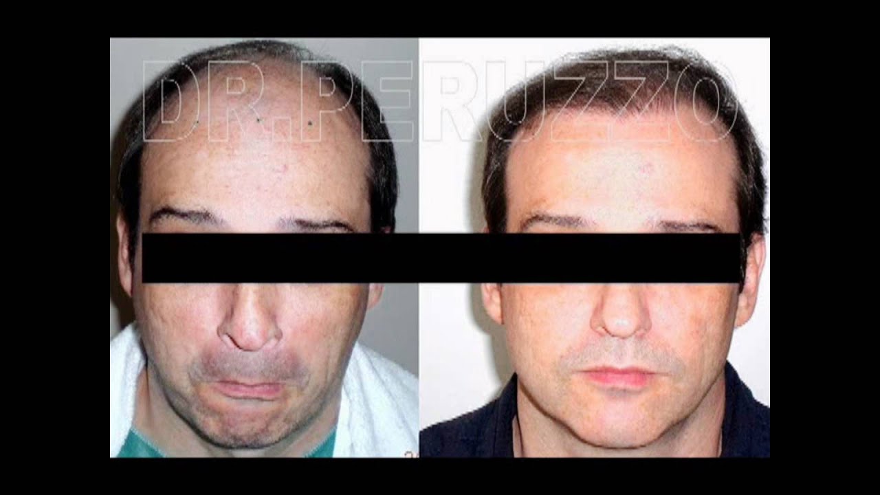 Relíquia, entrevista antiga, MUITO antiga, rádio.....Entrevista com Dr ...