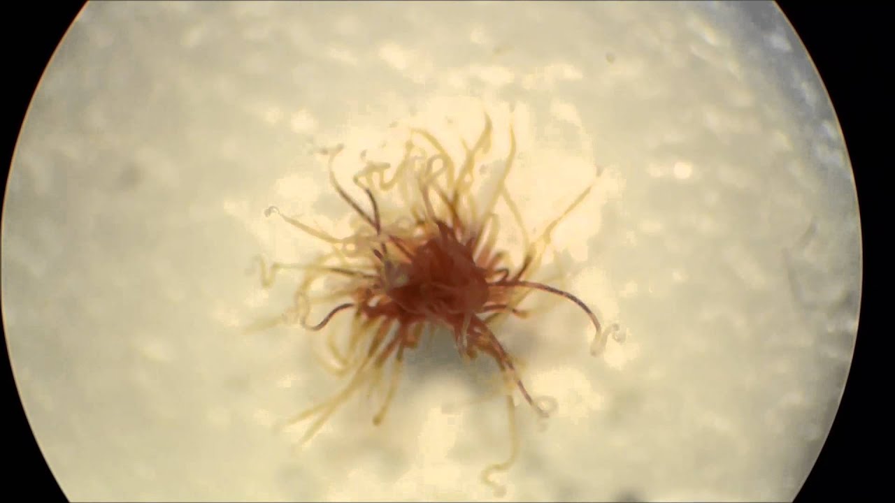 "Rat King" trematode cercaria - YouTube