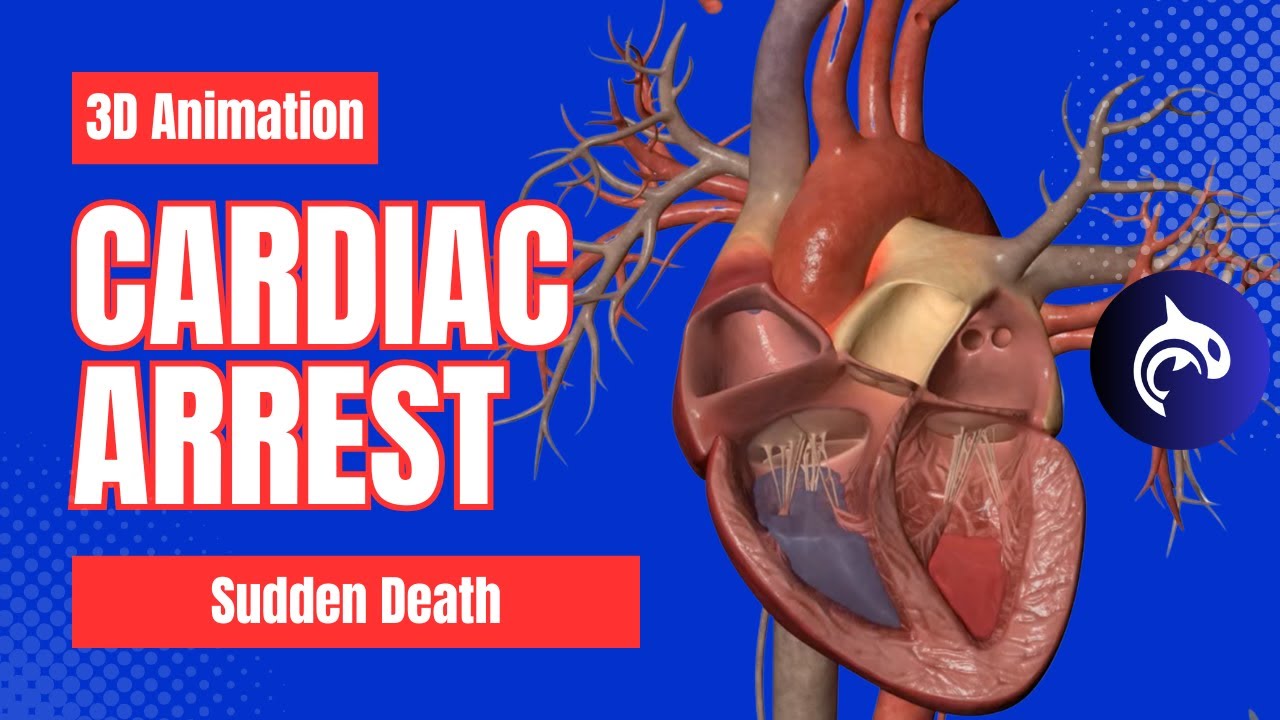 Cardiac Arrest Sudden Death 3d Animation Youtube