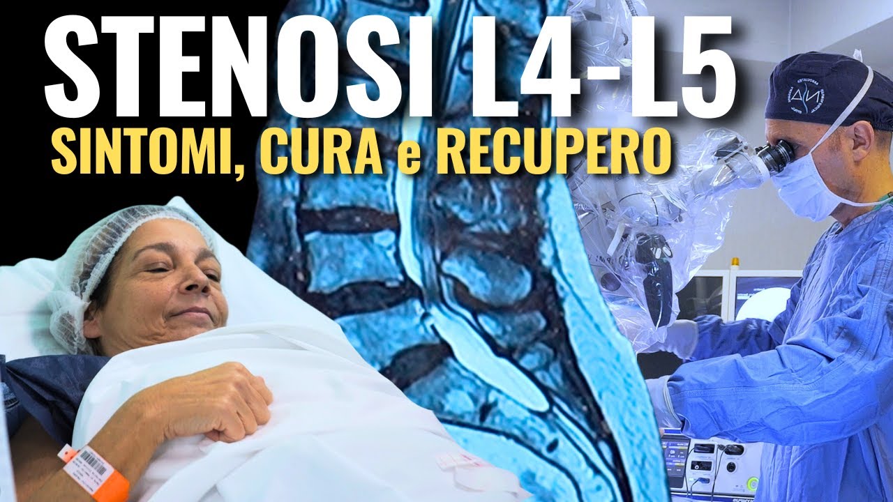 Stenosi L4-L5, con Fibromialgia e Artrite Psoriasica: Diagnosi, Cura e ...