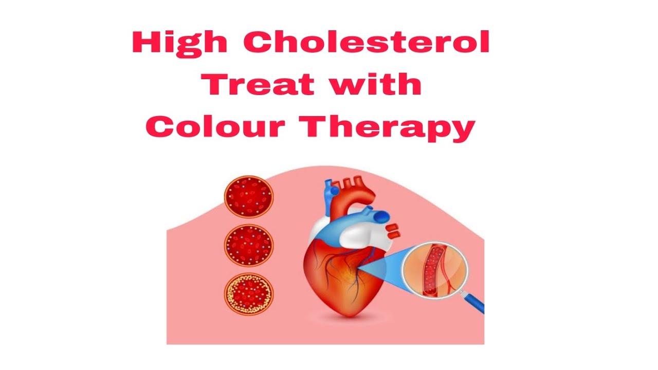 High Cholesterol- Treat with Colour Therapy - YouTube