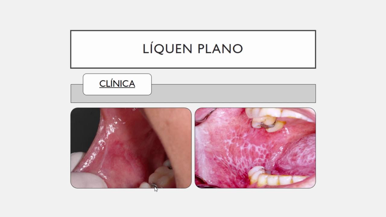 03 - DOENÇAS DERMATOMUCOSAS - YouTube