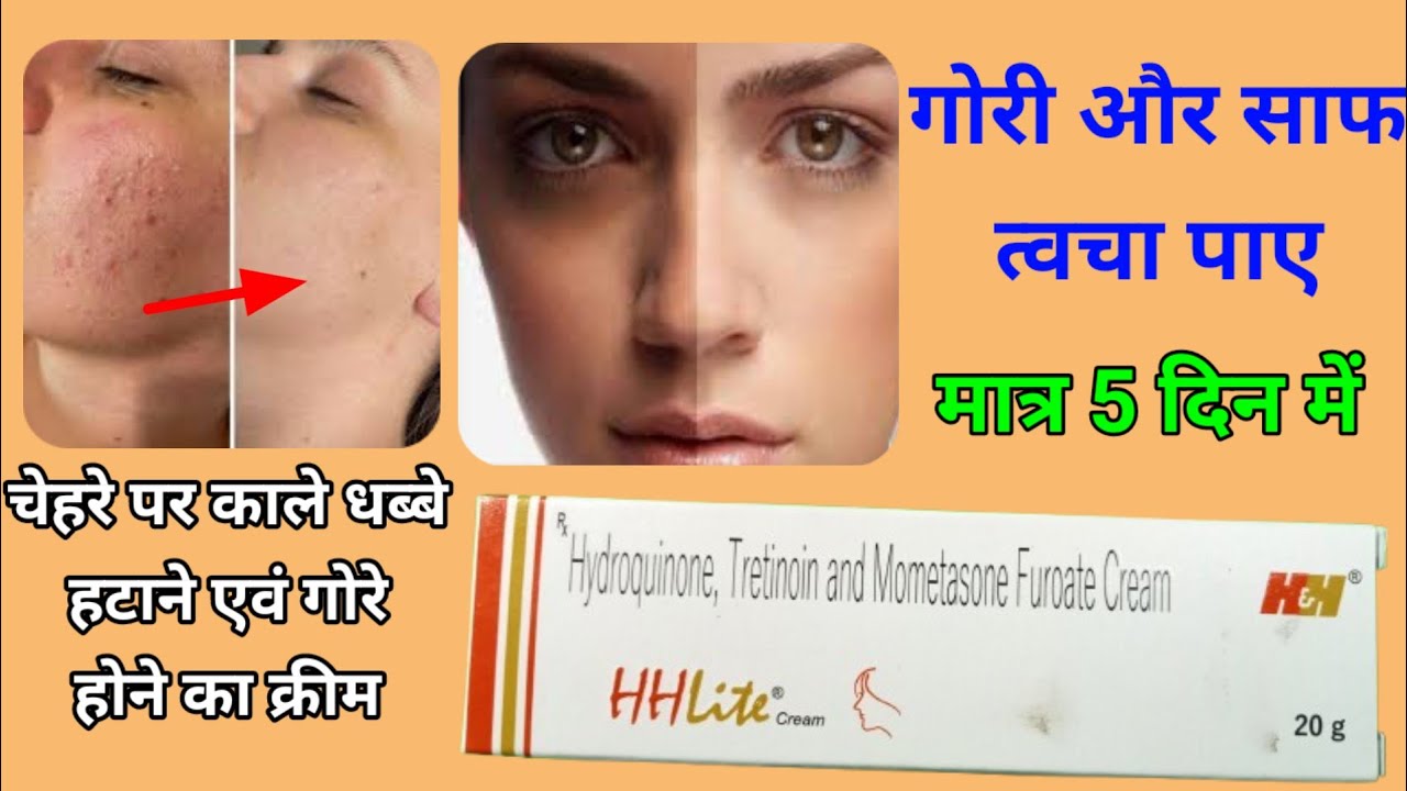 "Hhlite Cream Review || Gore Hone Ka Best Cream चेहरे के काले निशान और ...