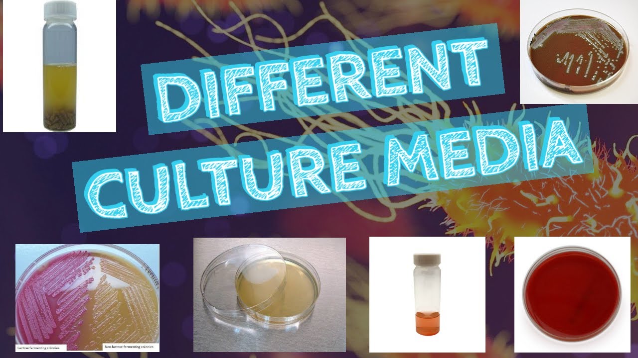Viva Questions On CULTURE MEDIA Microbiology Practical Exam YouTube viva-questions-on-culture-media-microbiology-practical-exam-youtube