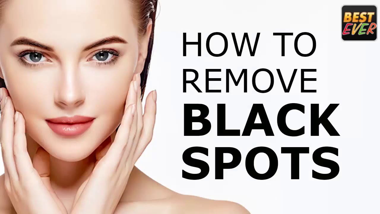HoW TO REMOVE BLOCK SPOT DARK SPOT AND ACNE YouTube how-to-remove-block-spot-dark-spot-and-acne-youtube