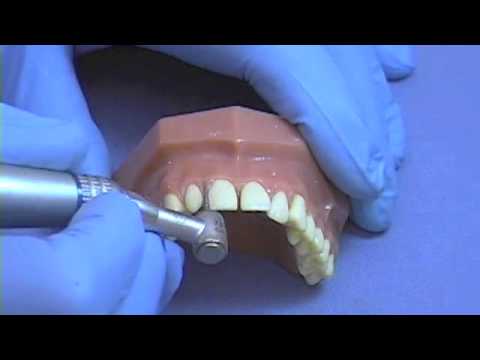 IMPROVED DENTAL HANDPIECE POSITION - YouTube