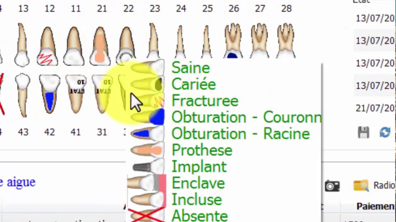 LOGICIEL DENTAIRE AppDent ( ODONTOGRAM ) - YouTube