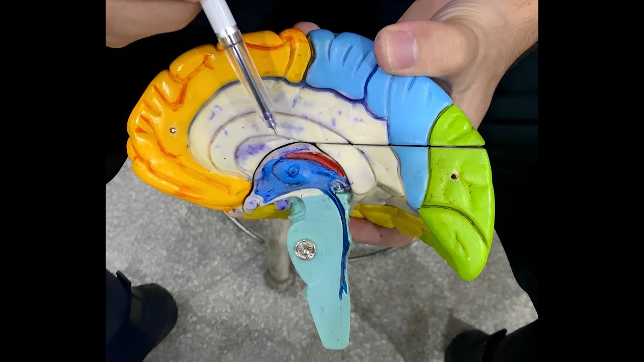Cerebral Aqueduct | Third Ventricle | Brain | NeuroAnatomy | Model ...
