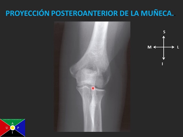 Radiografía De Anatomía Del Codo