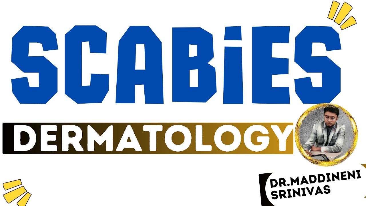 SCABIES | Cause Clinical features Management | Norwegian/Crusted ...
