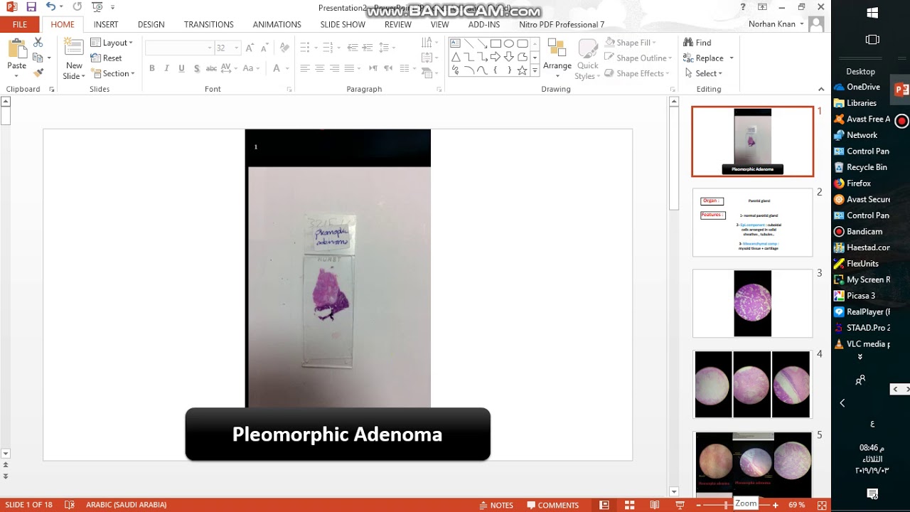 Practical Pathology ( slides ) Part 1 - GIT - YouTube