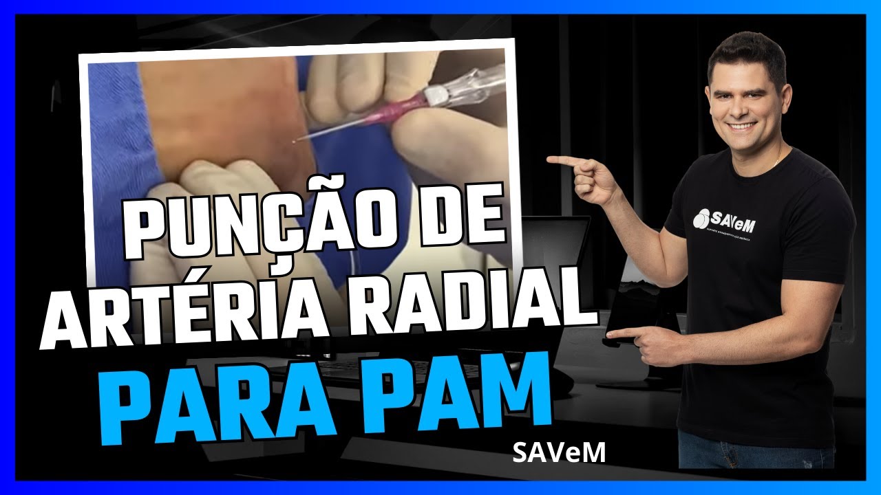 Cateterismo De Artéria Radial Para Pam - RETOEDU