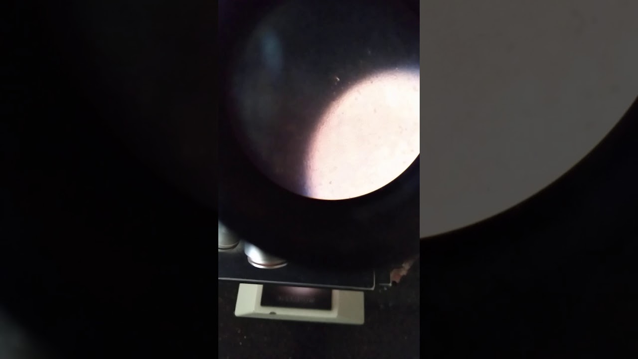 Urine routine, microscopic test,pathology lab - YouTube