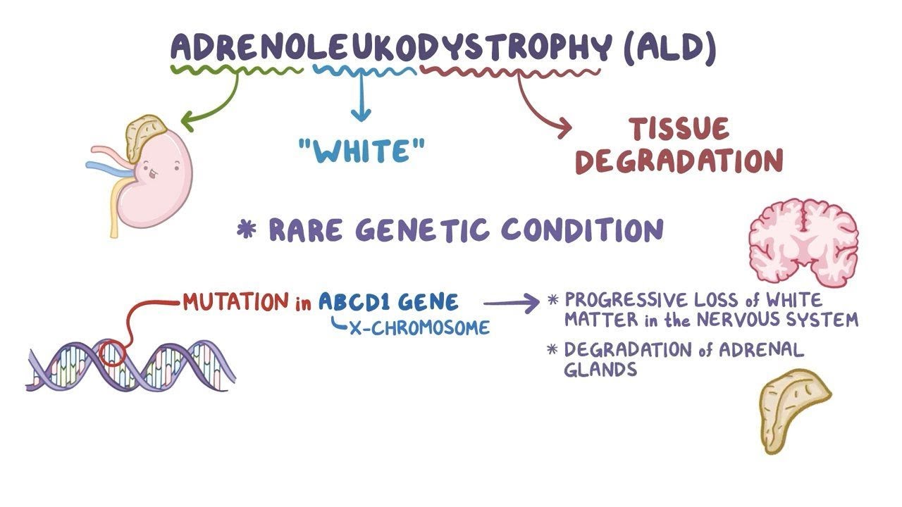 Experimental Adrenoleukodystrophy (ALD) Treatment - YouTube