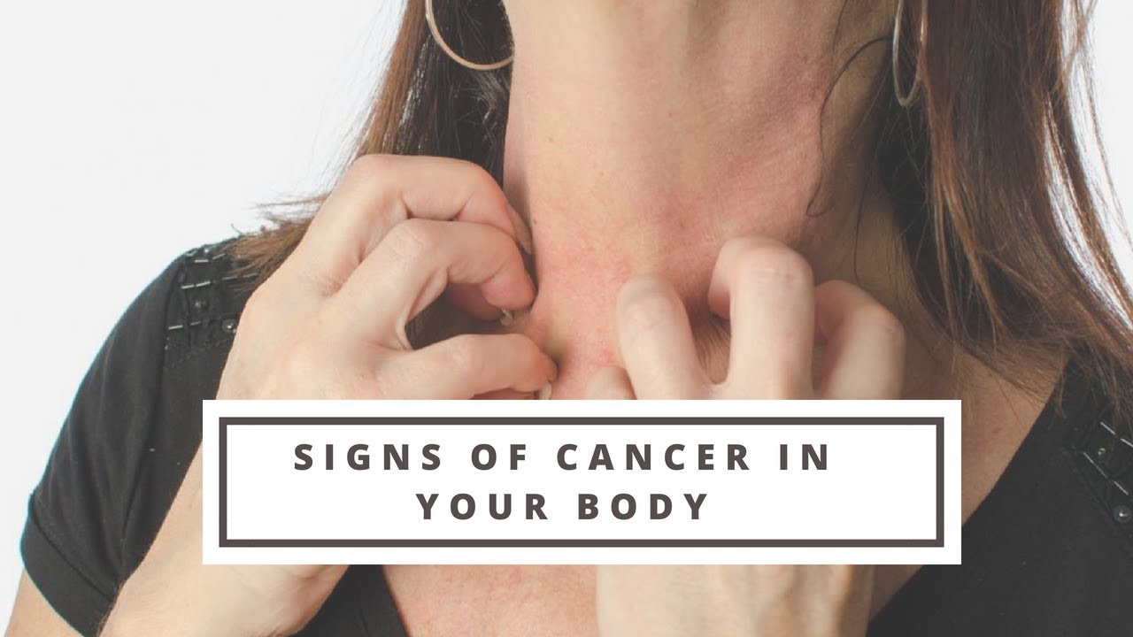 Early Warning Signs That Cancer Is Growing In Your Body - YouTube