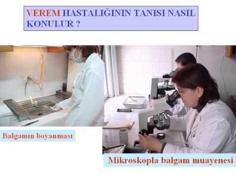 Verem ve Okul Eğitimi.avi