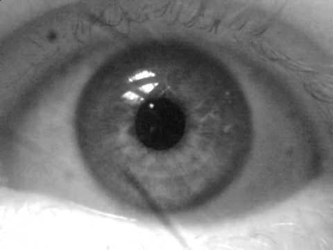 Incycloduction and Excycloduction! - YouTube