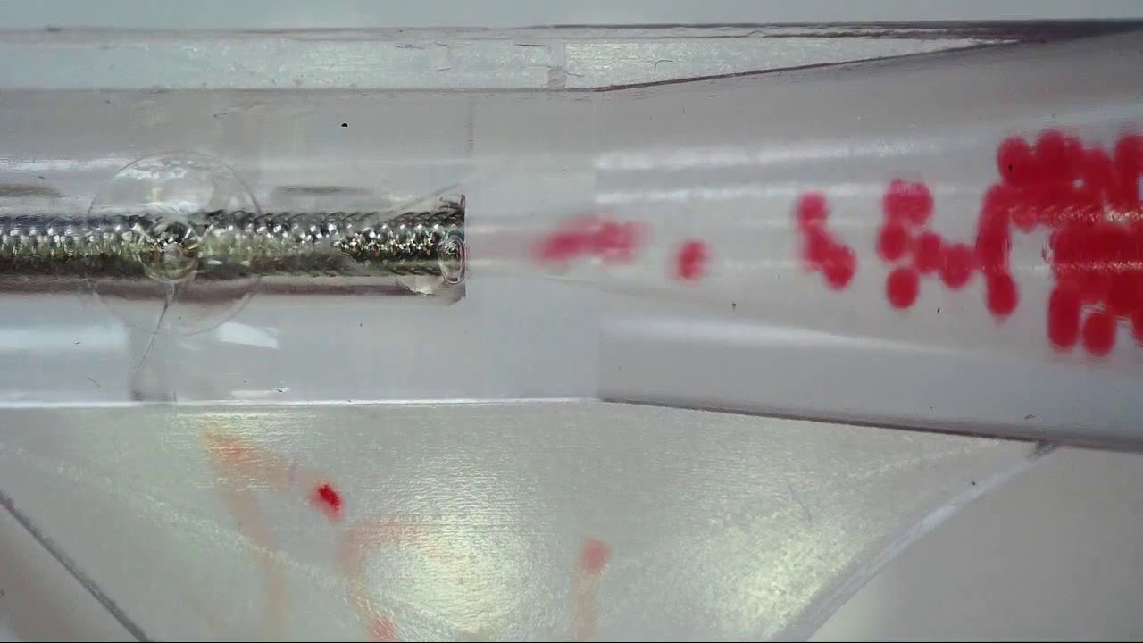 Microspheres/Beads During Embolization - YouTube