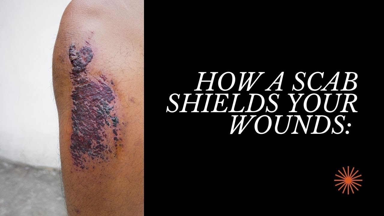 How a Scab Shields Your Wounds - YouTube
