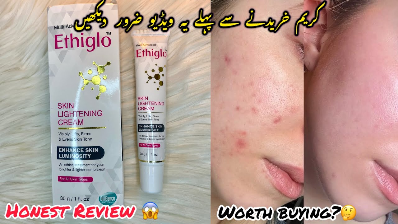 EthiGlow Skin Lightening Cream Review | Best Whitening Cream in ...