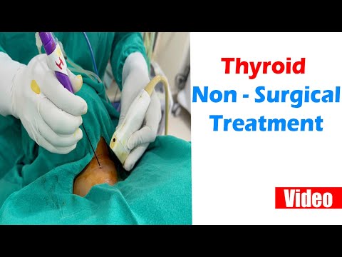 Non - Surgical Treatment for Thyroid | Citi Vascular Hospital | #nonsurgicaltreatments #thyroid