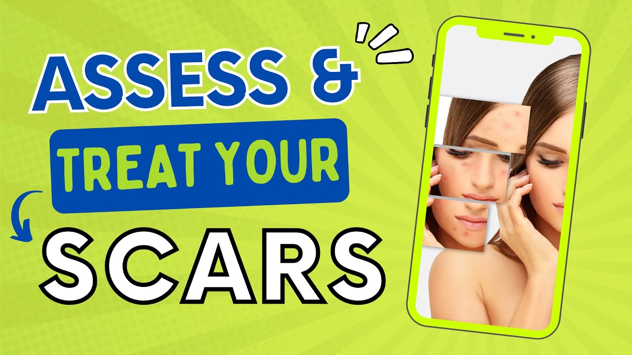 How to assess and treat your scars | Get rid of scar tissue - YouTube
