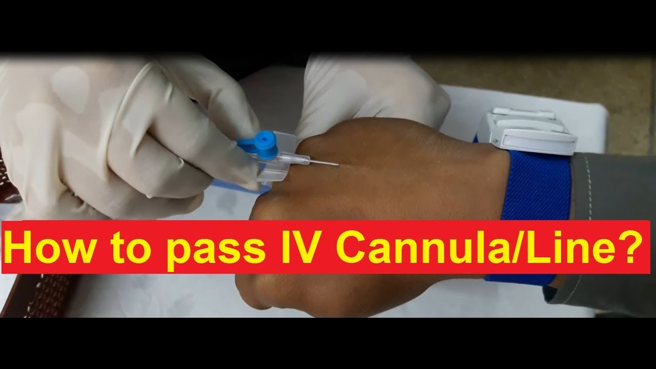 How to Pass IV Cannula? - YouTube