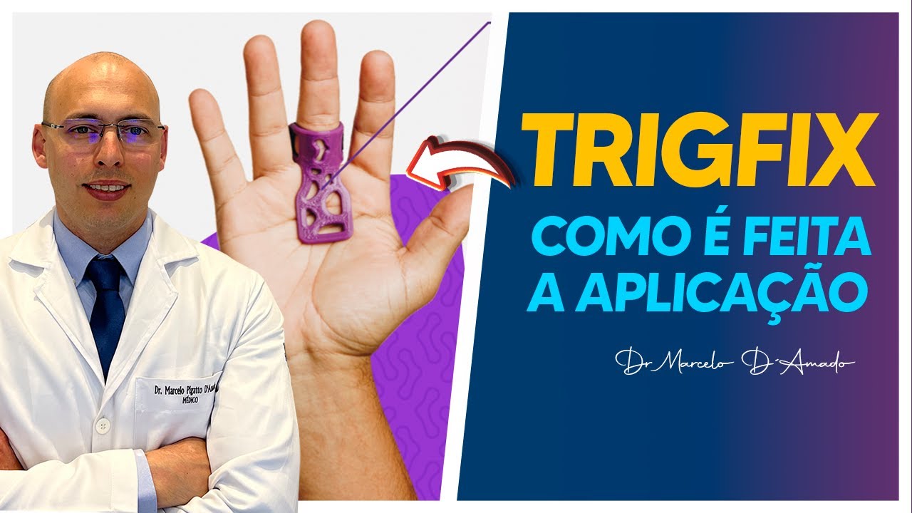 APLICAÇÃO DA ÓRTESE TRIGFIX | IMOBILIZAÇÃO PARA DEDO EM GATILHO - FIX ...