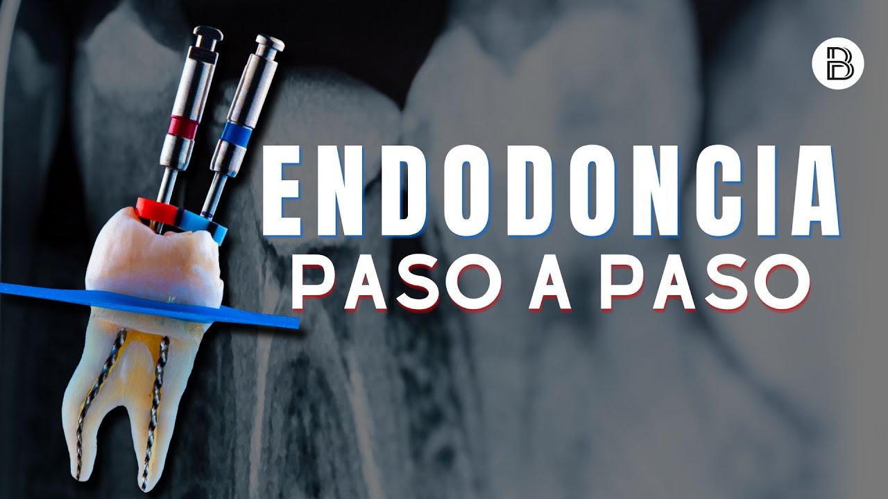 Endodoncia en Premolar Paso a Paso 🦷 | Guía Completa y Explicada - YouTube