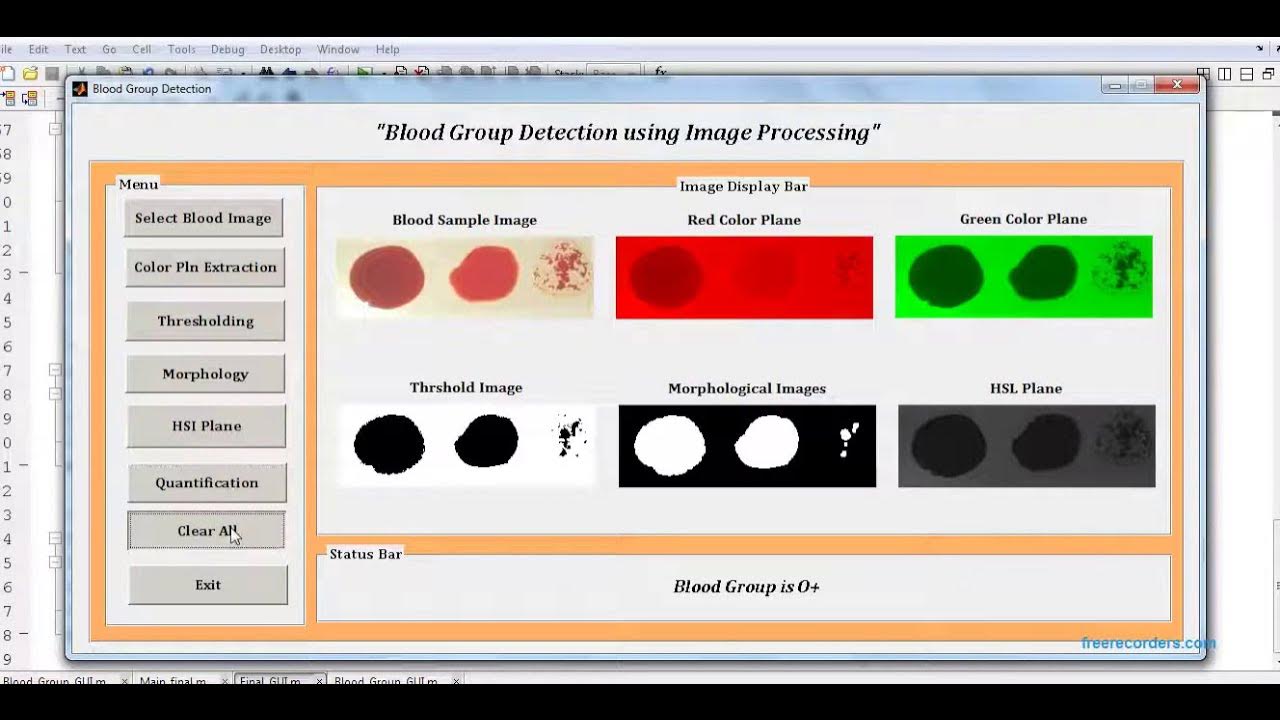 MATLAB code of Blood Group detection and WBC Detection - YouTube