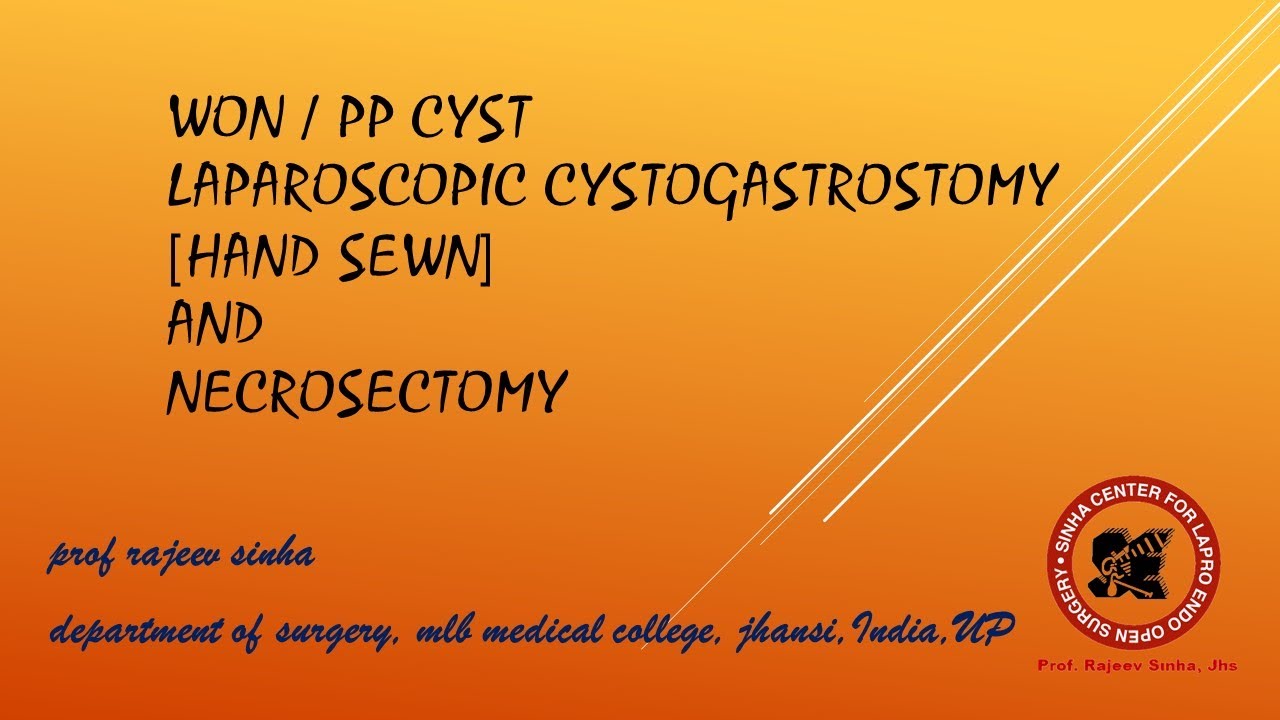 Pancreatic Pseudocyst/WON: Totally Laparoscopic pancreatic necrosectomy ...