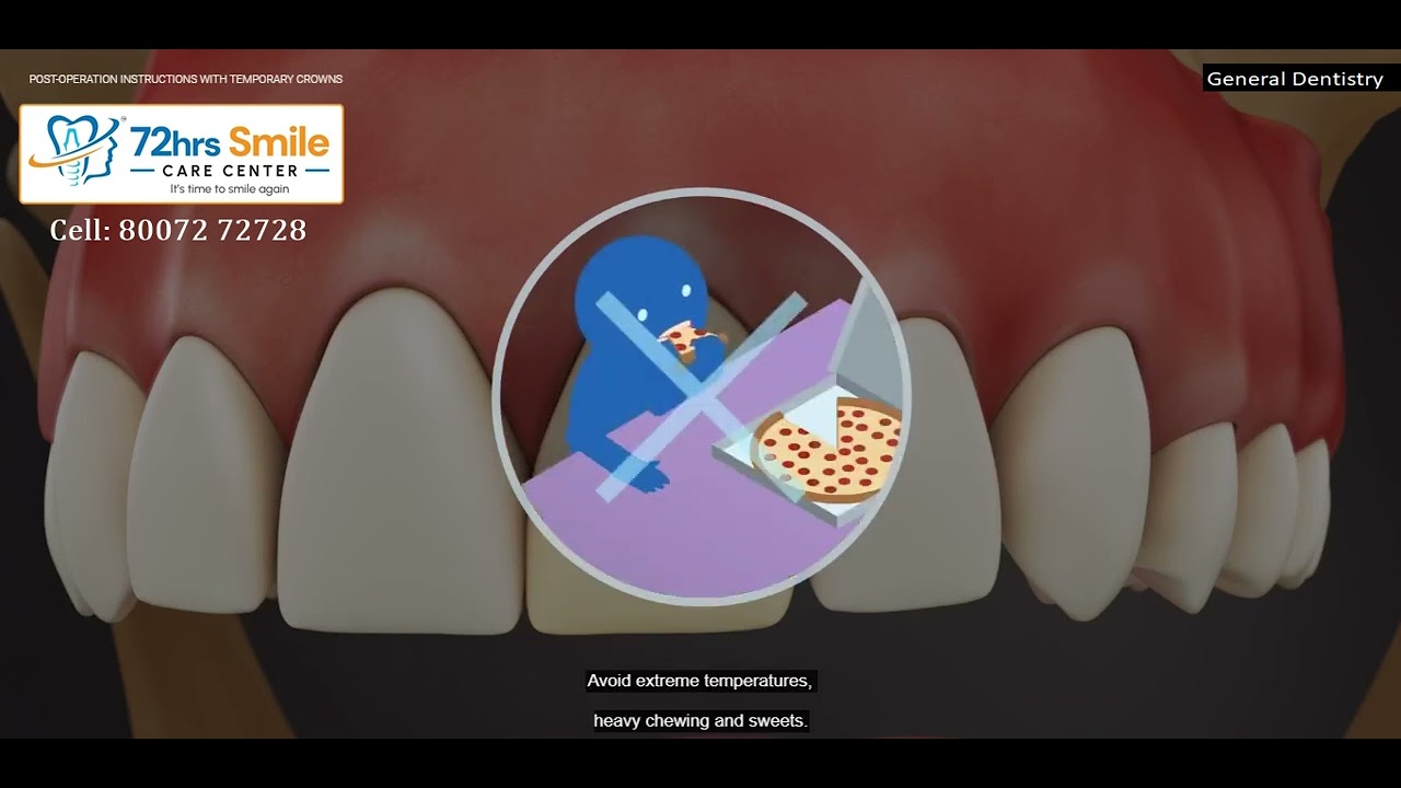 Post op instructions of dental Crowns- precautions we have to take ...