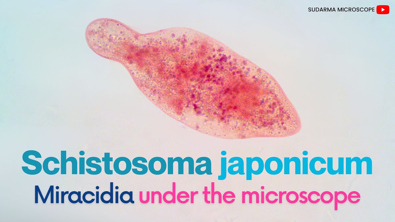 Schistosoma japonicum miracidia under the microscope - YouTube