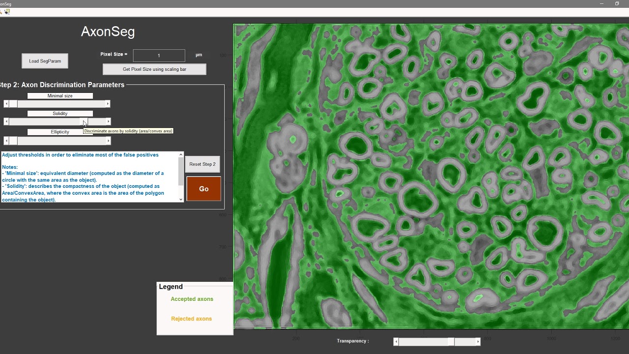 MATLAB Axon Segmentation Installation and Tutorial - YouTube