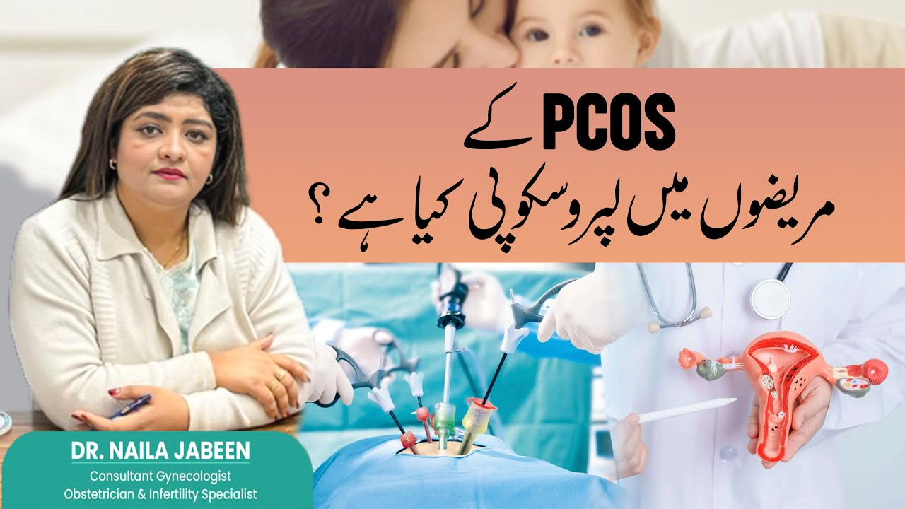 Laparoscopy for PCOS: Understanding the Procedure and Benefits | Dr ...