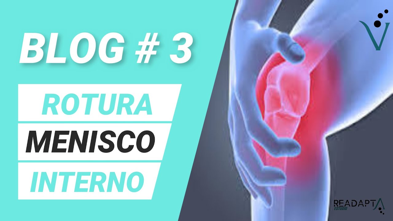ROTURA DE MENISCO INTERNO ¿ME OPERO O NO ME OPERO? - YouTube