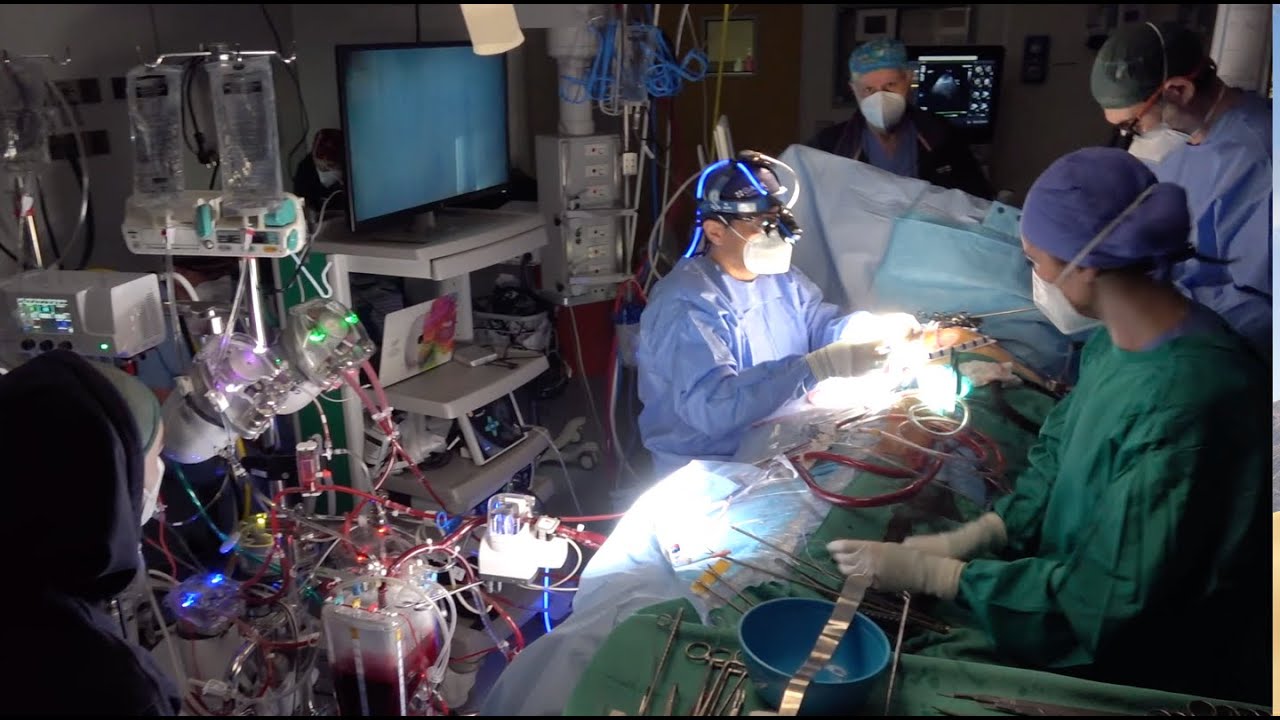 Trans-axillary MVR after failed transapical neochord repair (short ...