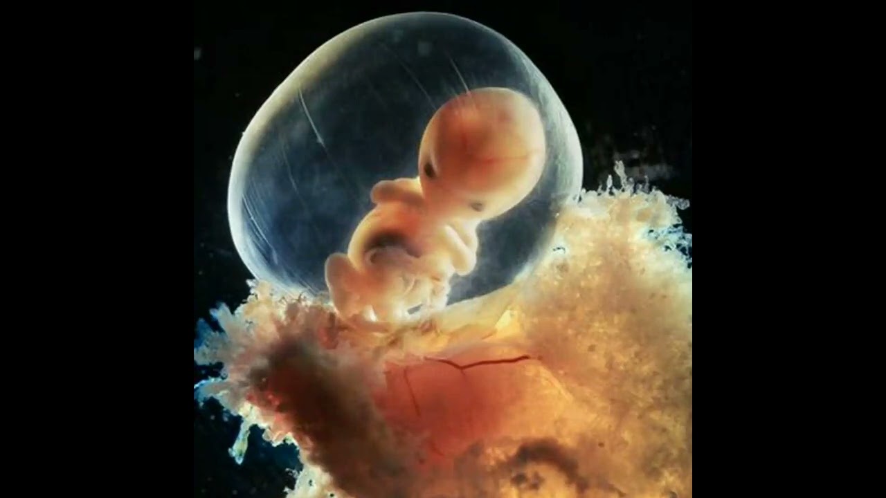 Baby in amniotic sac few weeks old #short #shortsfeed #doctor - YouTube