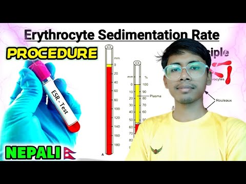 Erythrocyte sedimentation Rate (ESR) Estimation by wintrobe and ...