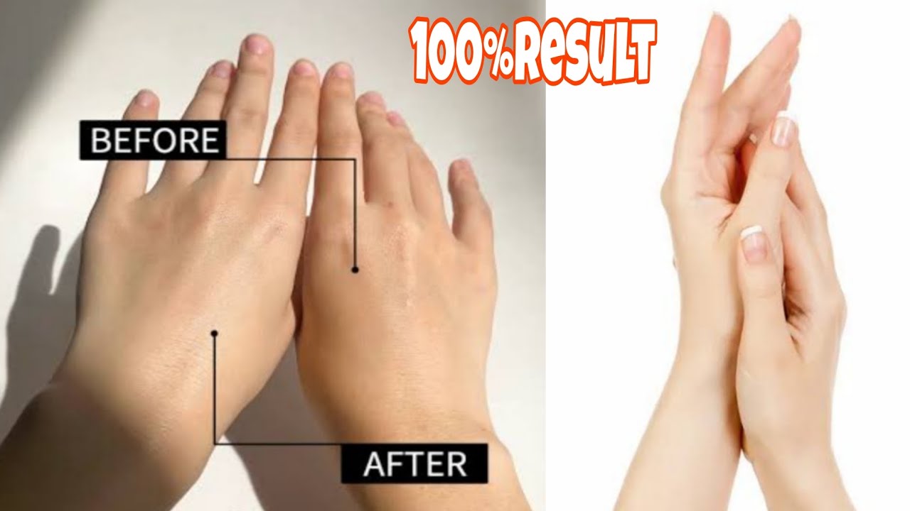 VIRAL Hand Whitening in 1day ️ / Bridal Special 2 Step Fair Hand at ...
